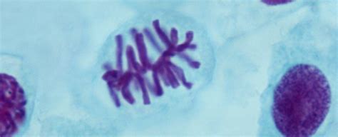 Chromosomes Revealed To Look Different Than Expected In Never Seen
