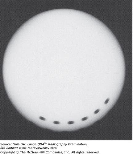 RAD Review Flashcards Quizlet