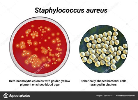 Blood Agar Staphylococcus Aureus Bacteria Staphylococcus Aureus 3d