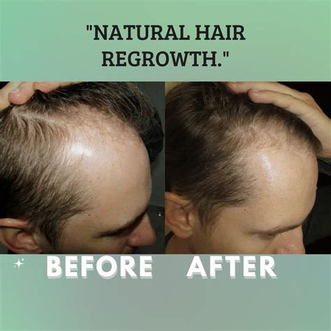 Stop And Regrow Natural Hair Regrowth Solution Stop And Regrow Natural Hair Regrowth Solution