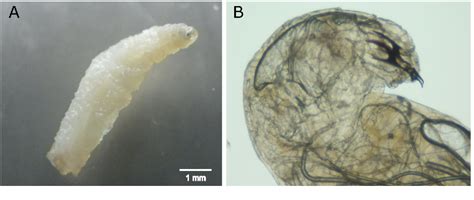 Figure 2 From Tracheostomy Wound Myiasis In A Patient With Hypoxic