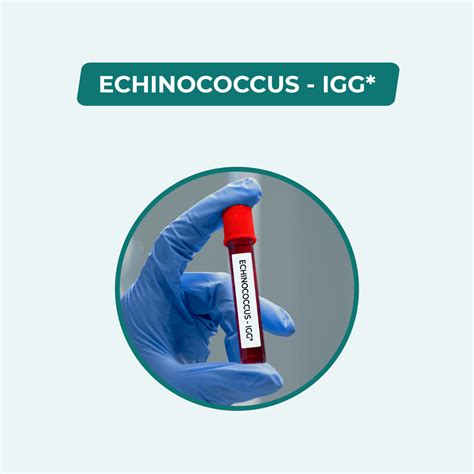 Echinococcus Igg Arogga Online Lab