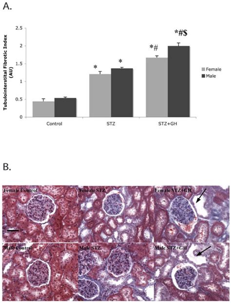 Effect Of Sex On Tifi In Control And Diabetic Rats Treated With And