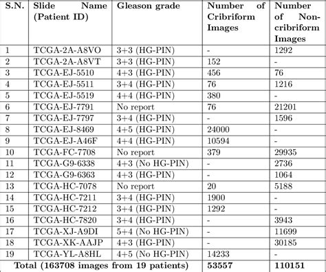 Cribriform Pattern Detection In Prostate Histopathological Images Using Deep Learning Models