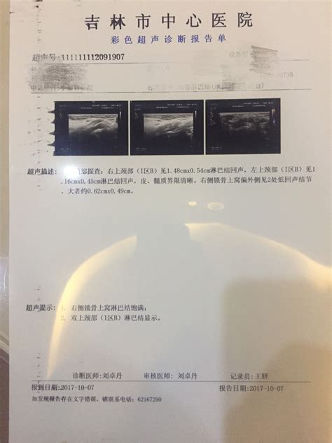颈部淋巴结彩超多少钱 颈部淋巴结 随意云