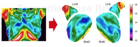 Method Used For ROI Segmentation Lin Accessory Breast And Lymph Node