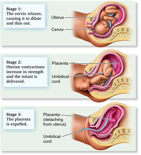 Stages Of Normal Delivery