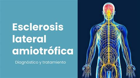 Esclerosis Lateral Amiotrófica Dianocito Rouleaux Udocz