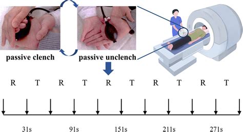 Block Design For Task‐based Fmri The Patients Clutched Their Hands