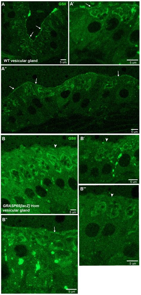 Gsii Alexa647 Lectin Staining Of Frozen Thin Sections Of Wild Type Download Scientific Diagram