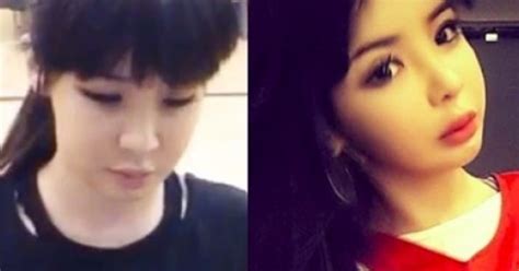 [리폿 이슈] 또 달라진 얼굴 박봄 자꾸 무엇을 바꾸려 하나