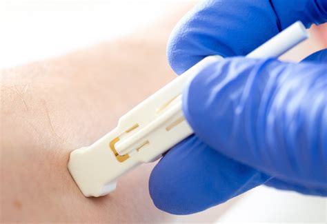 Microsampling Blog Neoteryx Skin Microsampling Microbiopsy