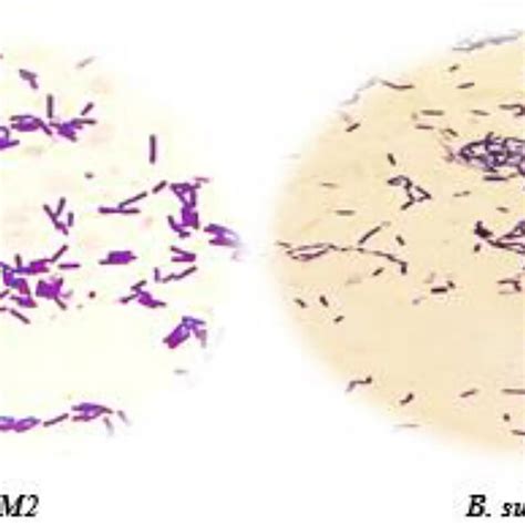 Gram Staining Reaction Of Bacteria Isolates Download Scientific Diagram