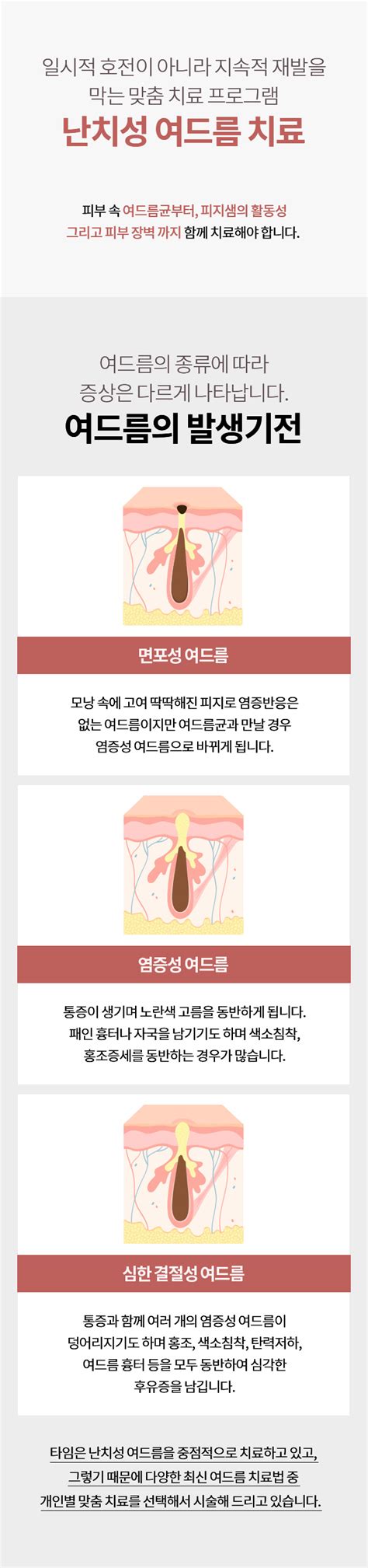 여드름 부평타임의원