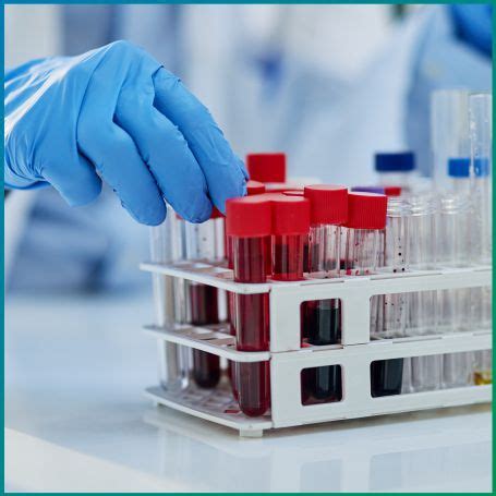 C3 Complement Test Delhi Diagnopein