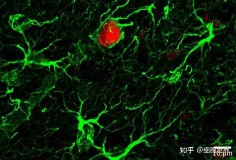 Cell Reports 冷泉港实验室单细胞分辨率器官3d重建研究前列腺癌 知乎