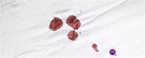 Vaginal Bleeding After Sex Saba