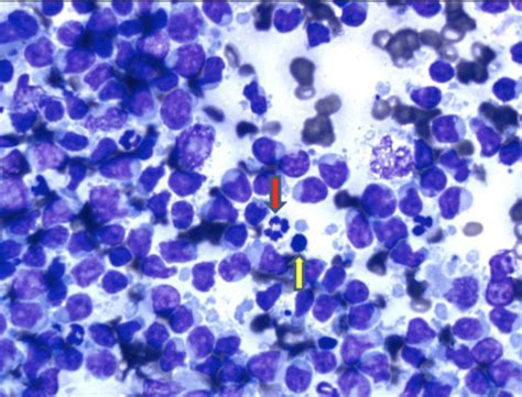 Exam 1 Cytology Round Cell Tumors Flashcards Quizlet