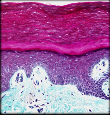 Lab Practical Integument Integumentary System Flashcards Quizlet