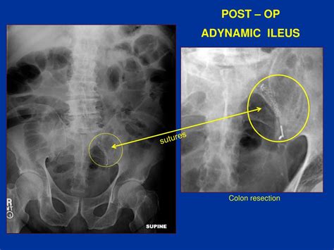 Ppt Gastrointestinal Imaging Powerpoint Presentation Free Download
