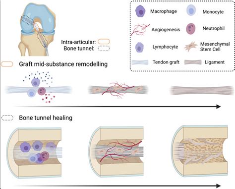 Acl Graft Selection And Early Mid Stage Rehab Considerations For The Rehab Professional
