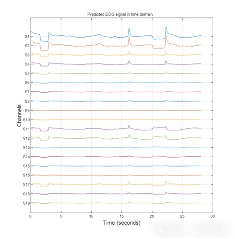基于盲源分离和半盲源分离的心电信号伪影消除方法（matlab 2018） Ew帮帮网