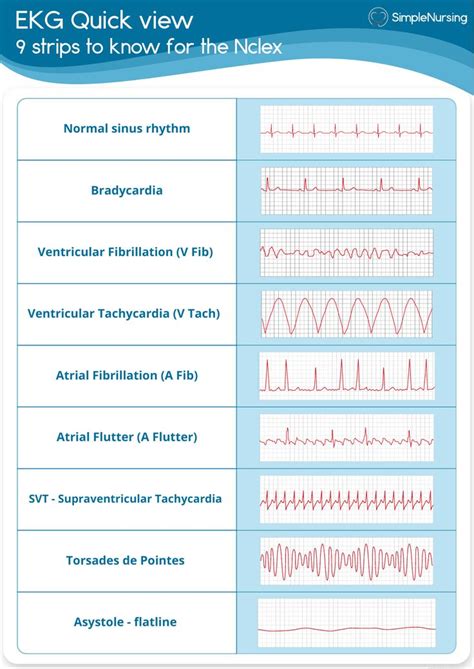 Learn About Ekg And Ecg With Simple Nursing
