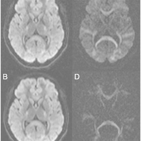 Typical DTI Workflow In Order To Perform A DTI Study Researchers Need Download Scientific