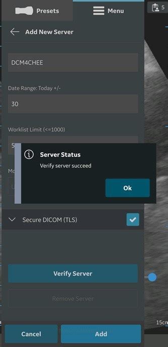 Configure Modality Worklist Server Vscan Air