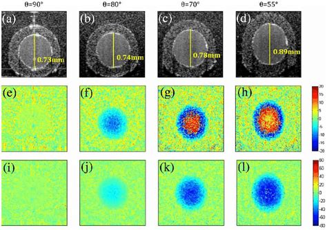 Doppler Angle Measurement And Absolute Flow Velocity Calculation In The