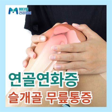 가만히 서있는데 무릎이 아파요 20대 슬개골연골연화증 증상 치료 연골연화증 통증 무릎 뚝소리 네이버 블로그