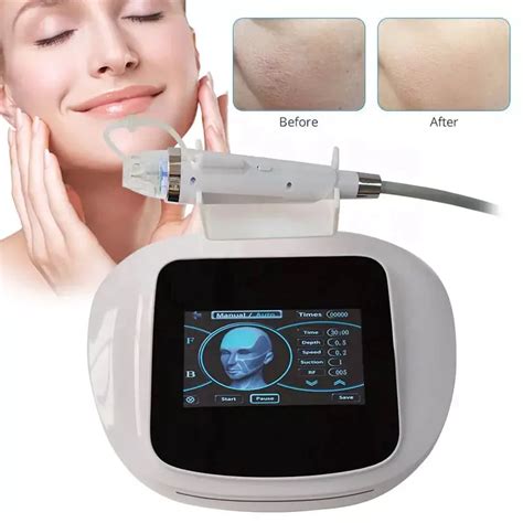 2023 하이엔드 휴대용 Rf 얼굴 미용 장비 고주파 분수 R F 크리스탈라이트 기계 스트레치 마크 여드름 제거 핸드폰닷컴