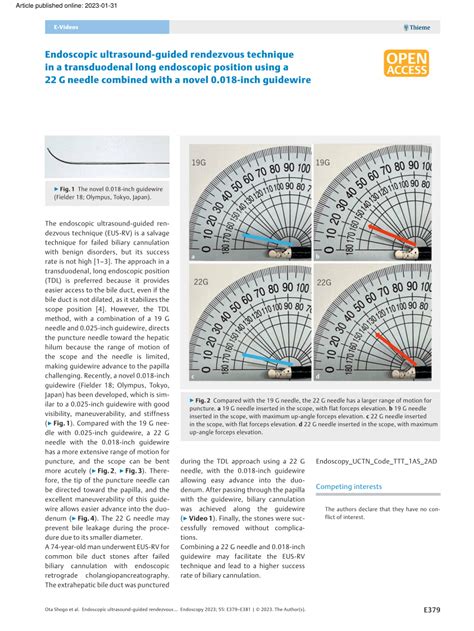 Pdf Endoscopic Ultrasound Guided Rendezvous Technique In A Transduodenal Long Endoscopic