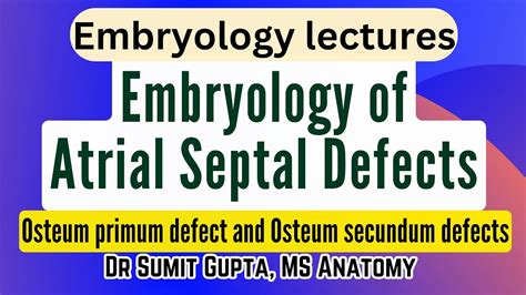 Atrial Septal Defects Embryological Basis Youtube