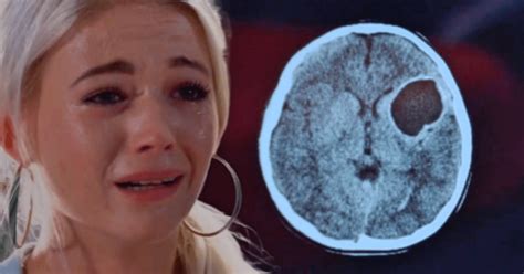 Eastenders Spoilers Lola Is Told Her Brain Tumour May Be Cancerous