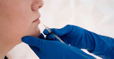 Profhilo Injection Stop Time And Restore Your Skins Youth