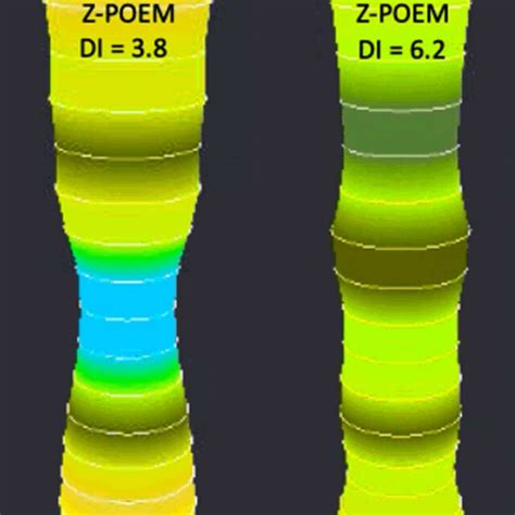 Graphical Representation Of Ues Morphology Before And After Z Poem Di Download Scientific