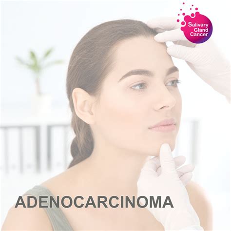 Hyalinising Clear Cell Carcinoma Ccc Salivary Gland Cancer Uk