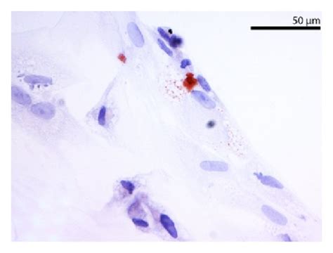 Adipogenic Differentiation Oil Red O Staining Oil Red O Staining