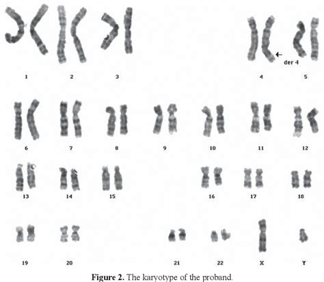 Figure 2 From A Partial Trisomy 2p P21→pter Derived From A Paternal T