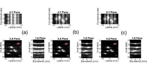 Figure 1 From Volumetric Super Resolution Ultrasound With A 1d Array