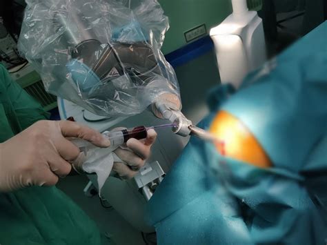 领航业务 我院成功开展全市首例神经外科机器人手术 庆阳市人民医院