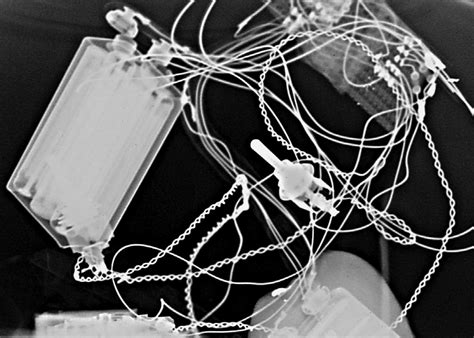 Scanx Scout Televere Systems