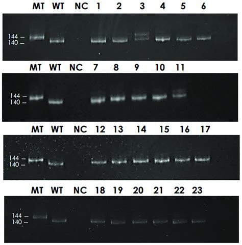 Detecting Npm1 Gene Mutations In Patient Samples Using A Standard Pcr Download Scientific