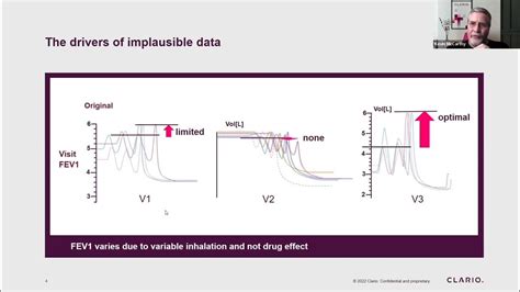 Achieving High Quality Spirometry Data In Decentralized And Hybrid
