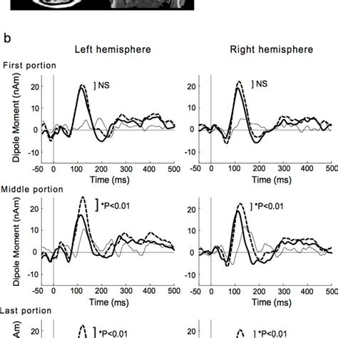Representative Equivalent Current Dipole Ecd Locations Dots And Download Scientific Diagram