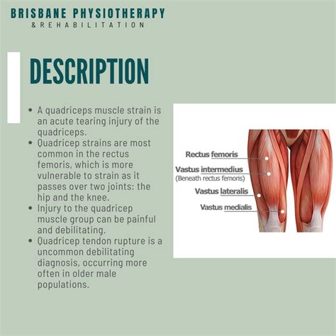 What Is A Quadricep Strain Brisbane Physiotherapy
