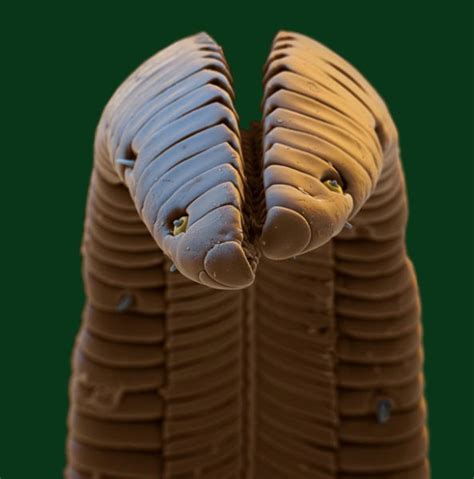 Amazing Scanning Electron Microscope Pictures 24 Pics