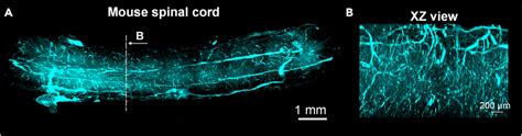 3d Visualization Of Vasculature Within Cleared Mouse Spinal Cord A Download Scientific