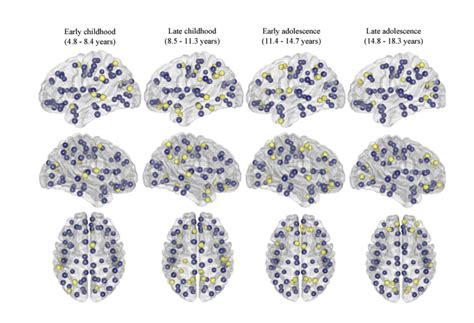 Neurodevelopment Mcgill Centre For Integrative Neuroscience